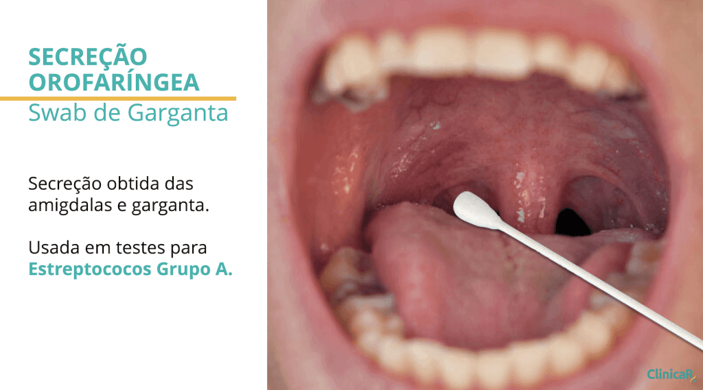 Estreptococos: Teste rápido para infecção de garganta